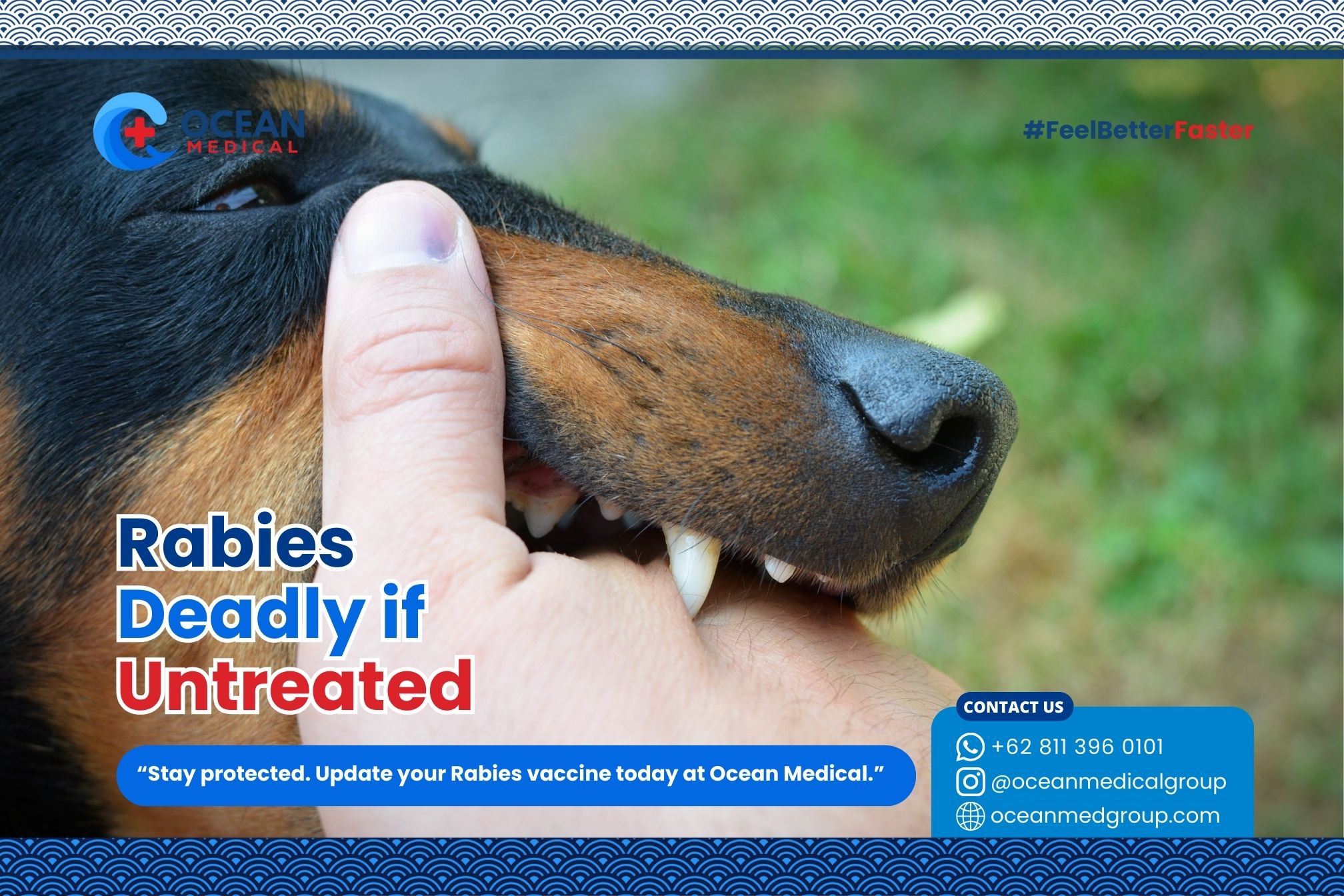 Rabies Deadly if Untreated